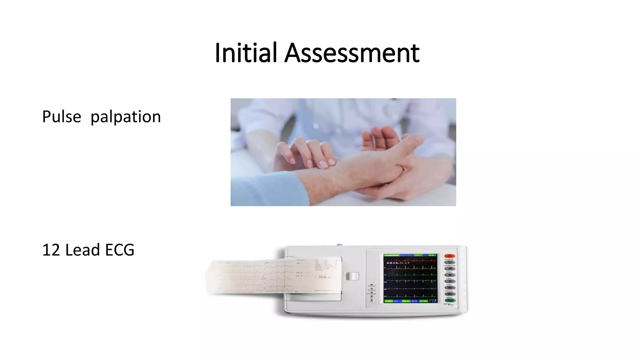 ATRIAL FIBRILLATION .pptx
