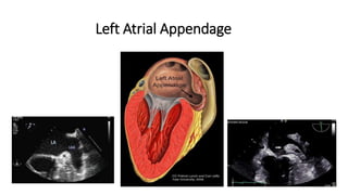 ATRIAL FIBRILLATION .pptx