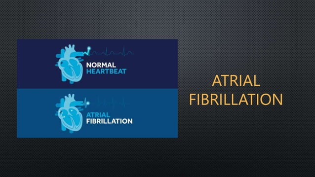 ATRIAL FIBRILLATION.pptx