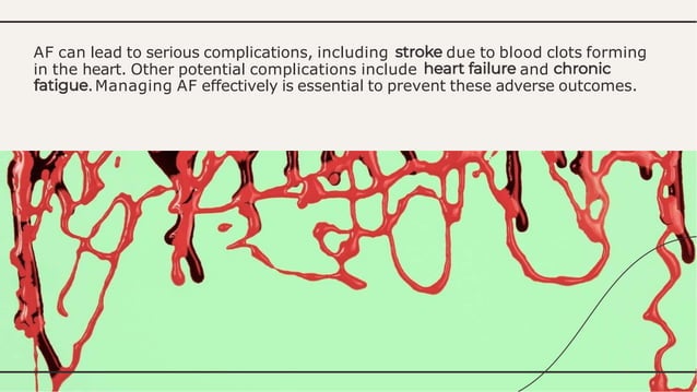 atrial fibrillation a concised review.pptx