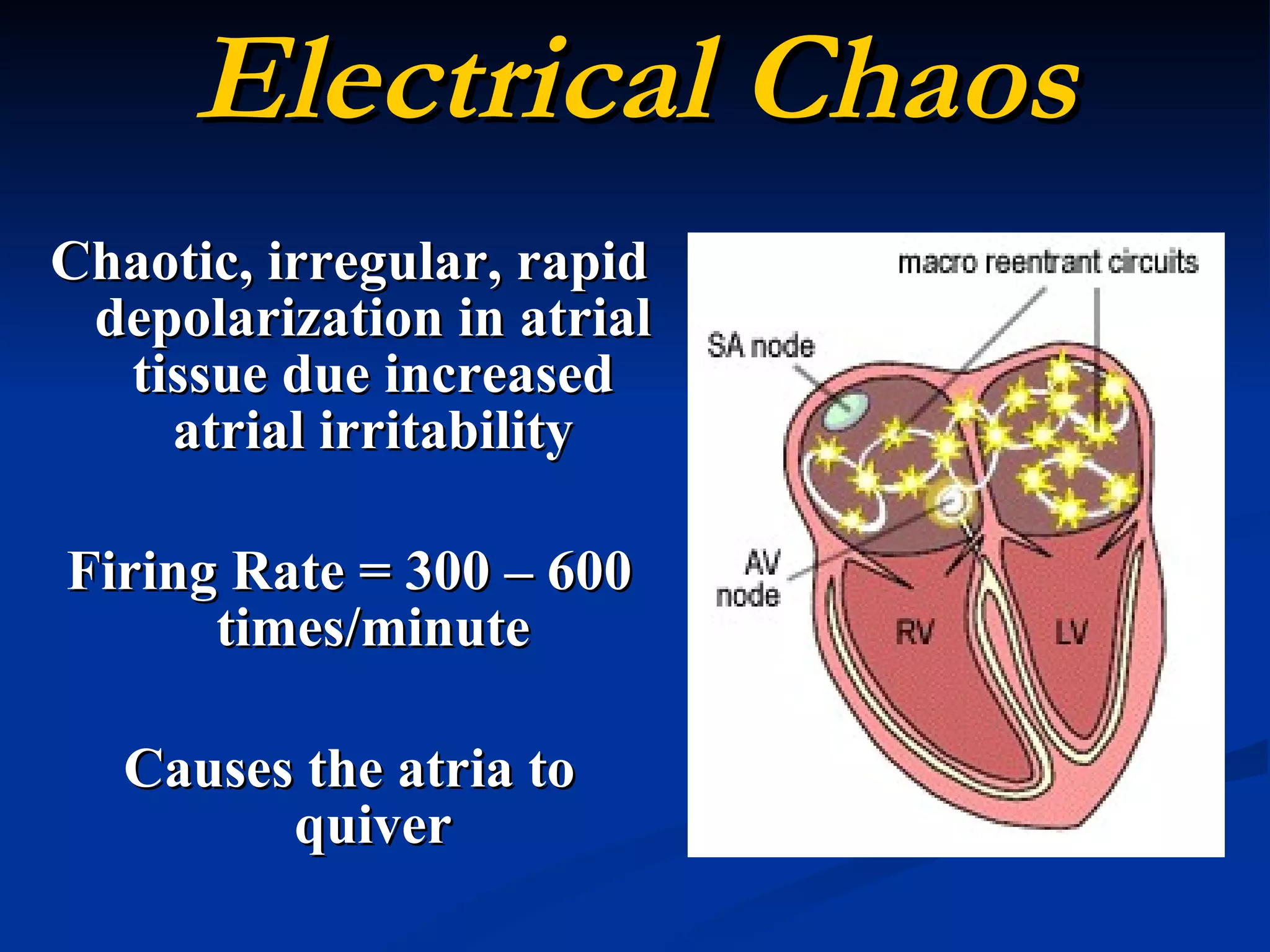 Atrial Fibrillation - BMH/Tele | PPT