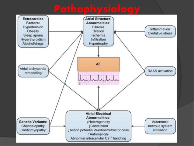 Nursing Concept Map For Atrial Fibrillation - United States Map