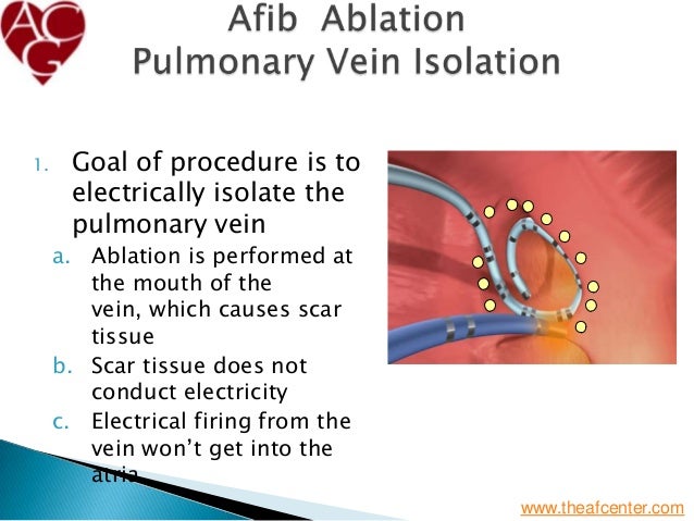 Atrial fibrillation ablation - A visual guide for patients