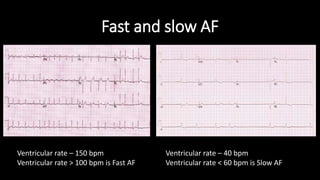 Atrial fibrillation - a surgical perspective | PPTX