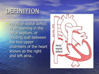 Atrialfinal (1) | PPT