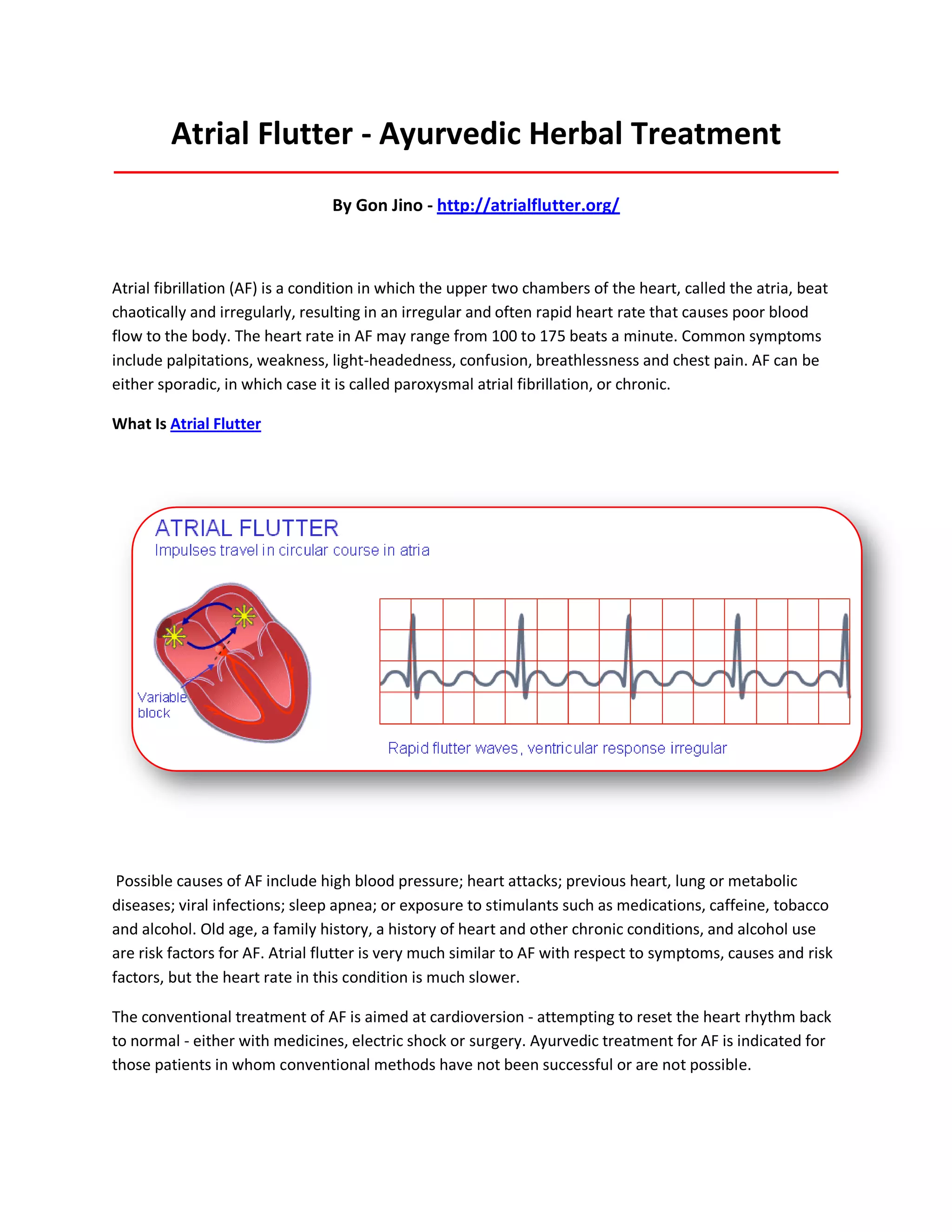 Atrial flutter | PDF