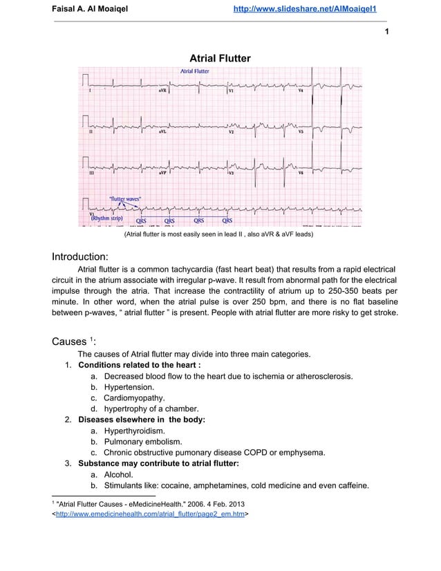 Atrial Flutter | PDF