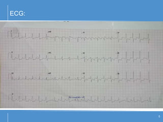 Atrial flutter (AFl) – management principals | PPTX