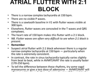 Atrial flutter and bradycardias | PPTX