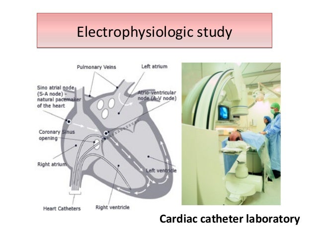 ECG Atrial and Junctional rhythms Dr Sarfaraz
