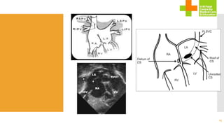 Atrial level shunts | PPTX