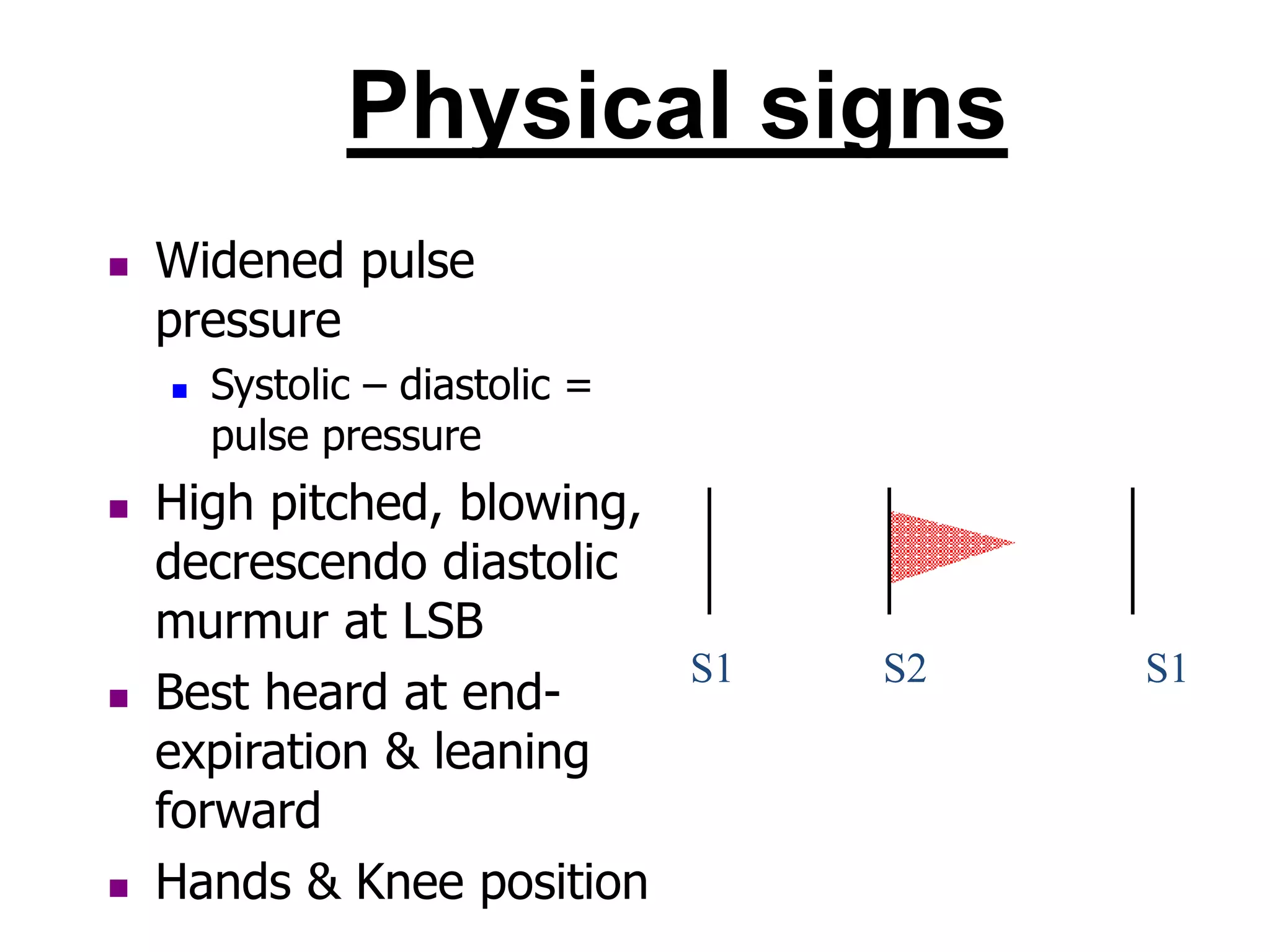 Atrial regurgitation | PPTX