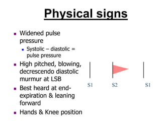 Atrial regurgitation | PPTX