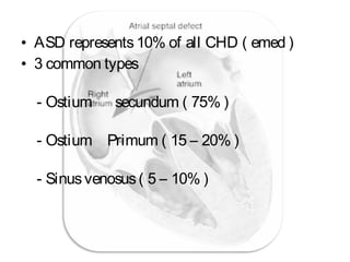 Atrial septal defect | PPT