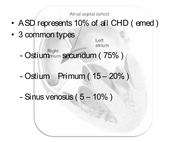 Atrial septal defect