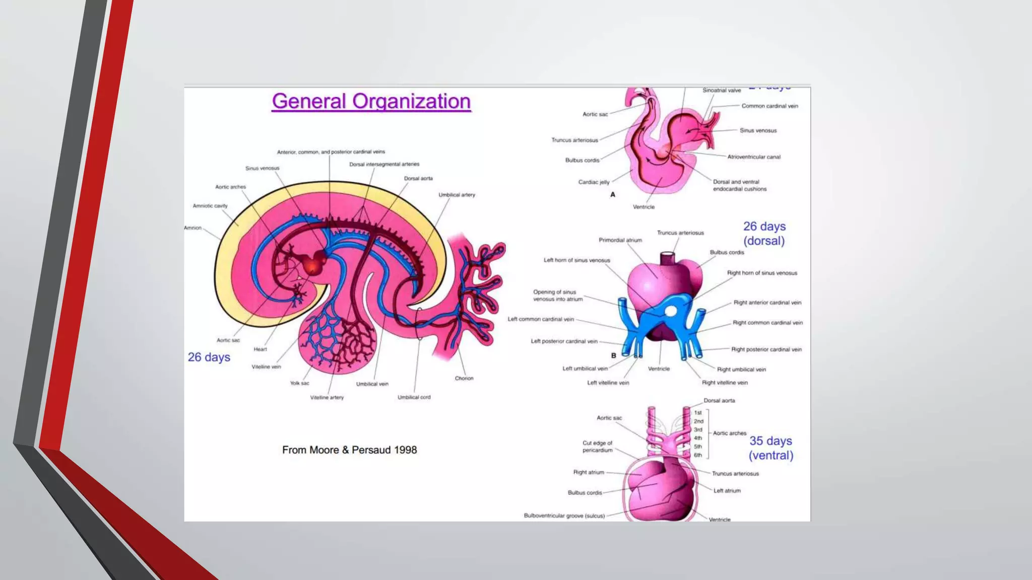 Atrial septal defect | PPTX
