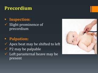 Atrial septal defect | PPT
