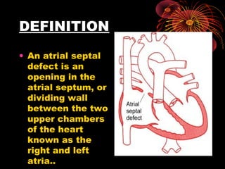 khaledsalah | PPT | Heart and Cardiovascular Diseases | Diseases and ...