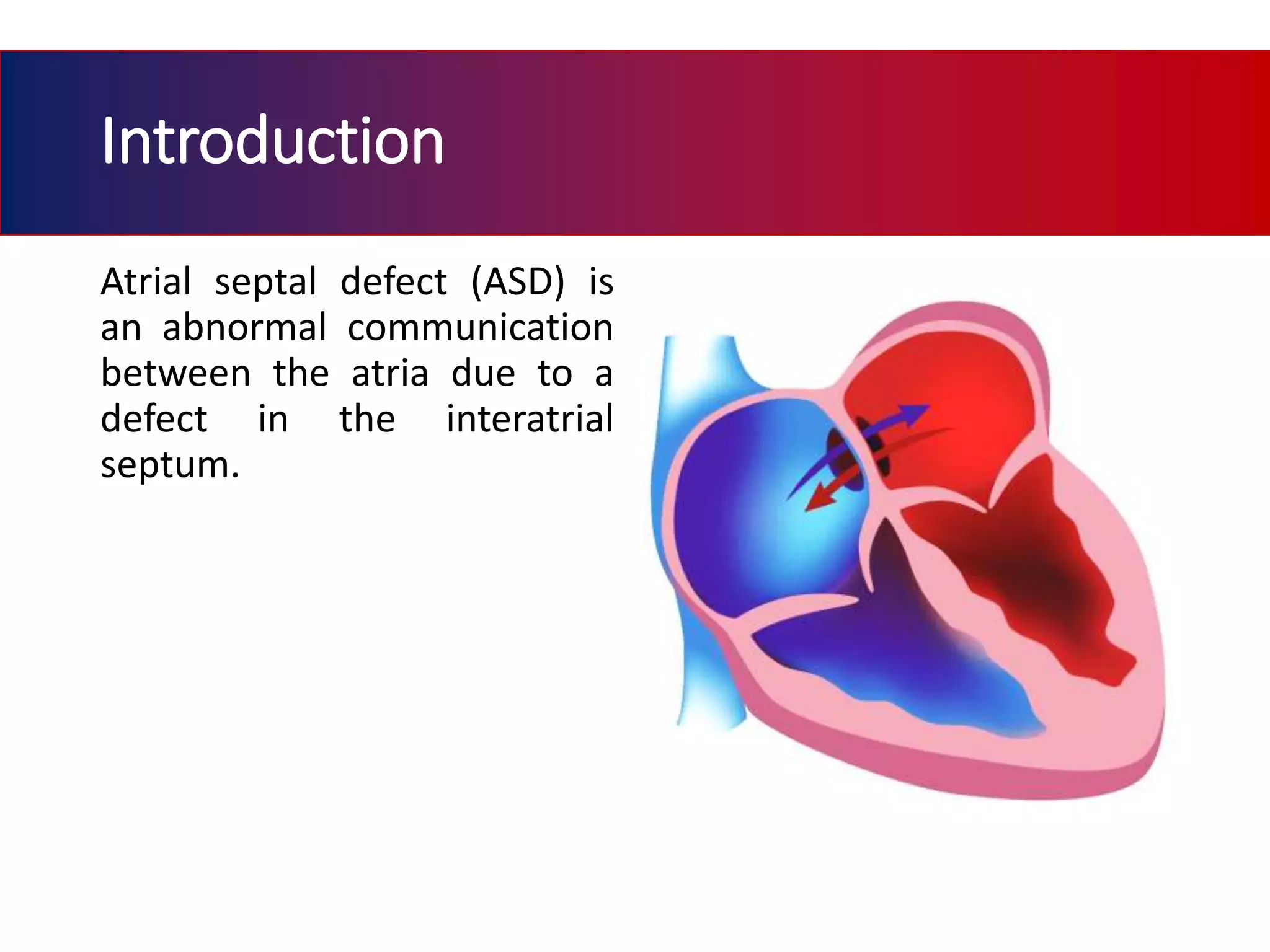 Atrial septal defect | PPTX