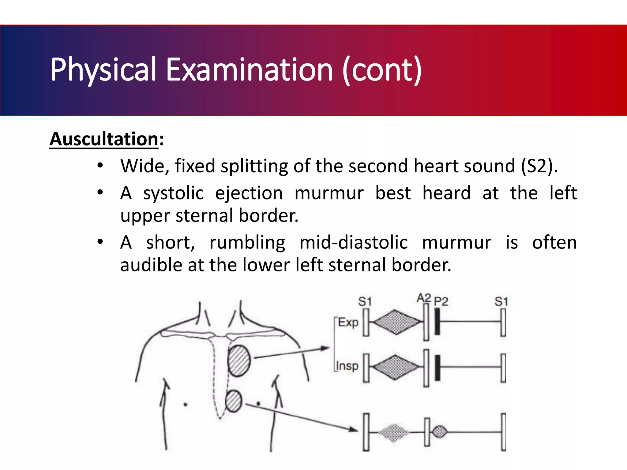 Atrial septal defect | PPTX