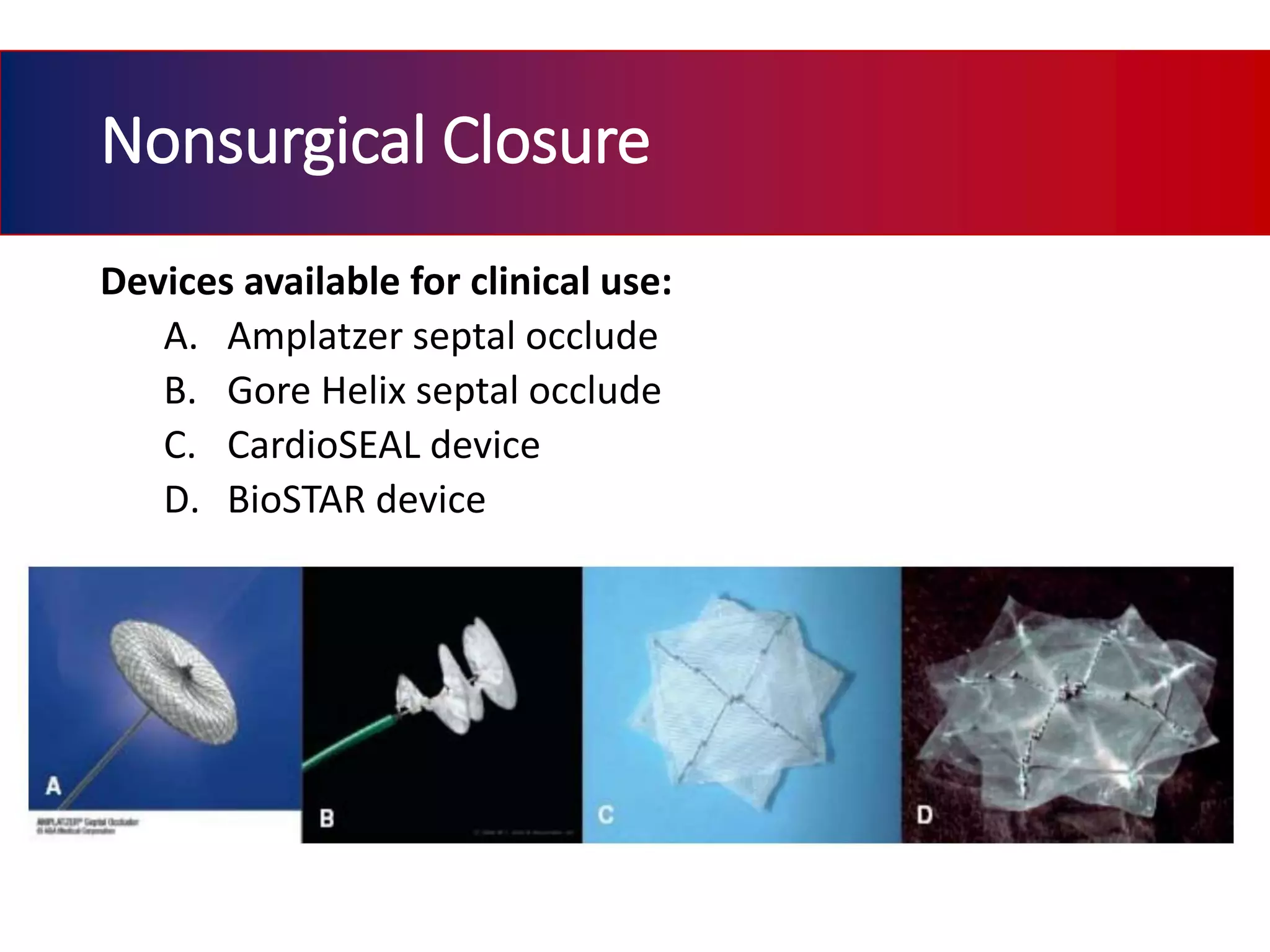 Atrial septal defect | PPTX