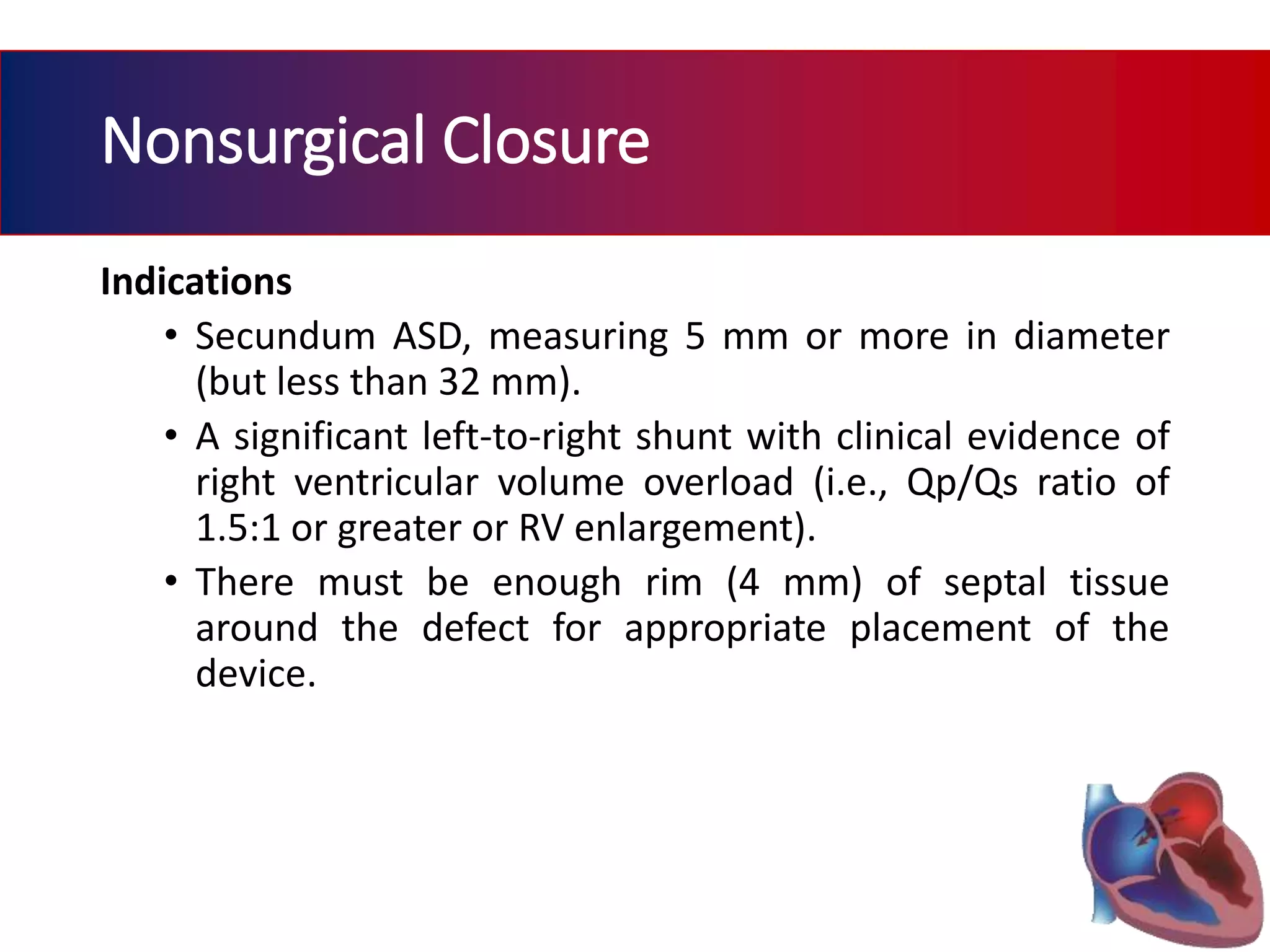 Atrial septal defect | PPTX