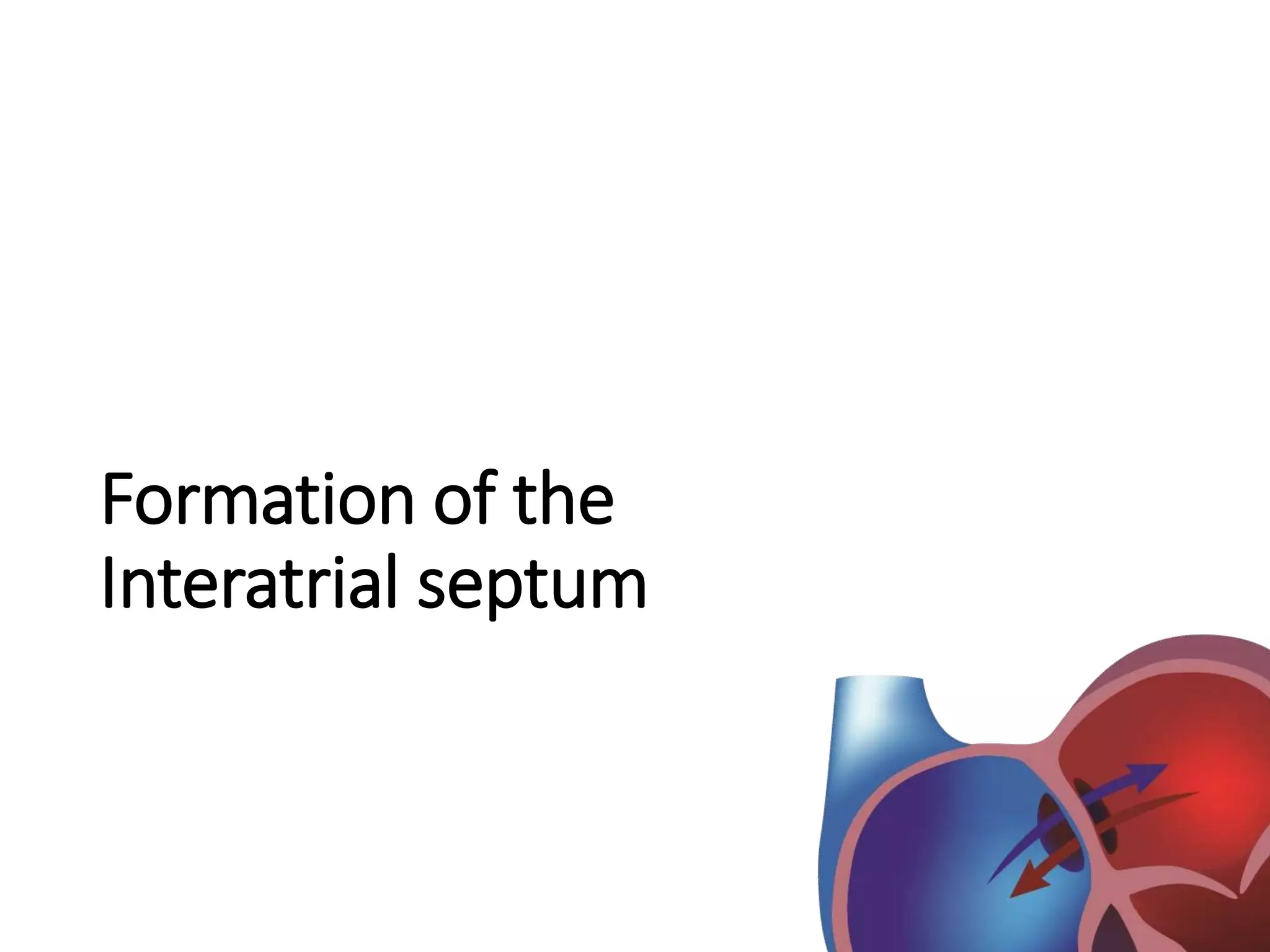 Atrial septal defect | PPTX