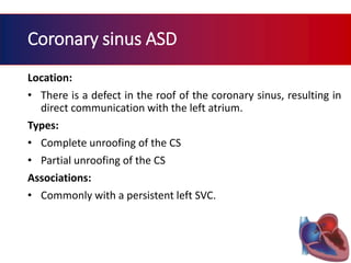 Atrial septal defect | PPTX