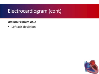 Atrial septal defect | PPTX