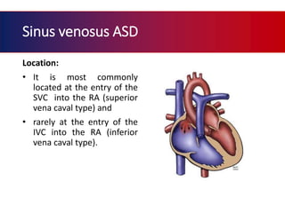 Atrial Septal Defect Types