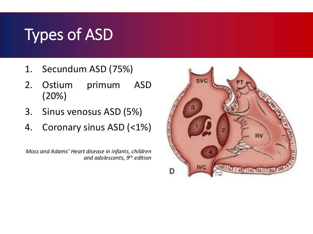 Atrial septal defect