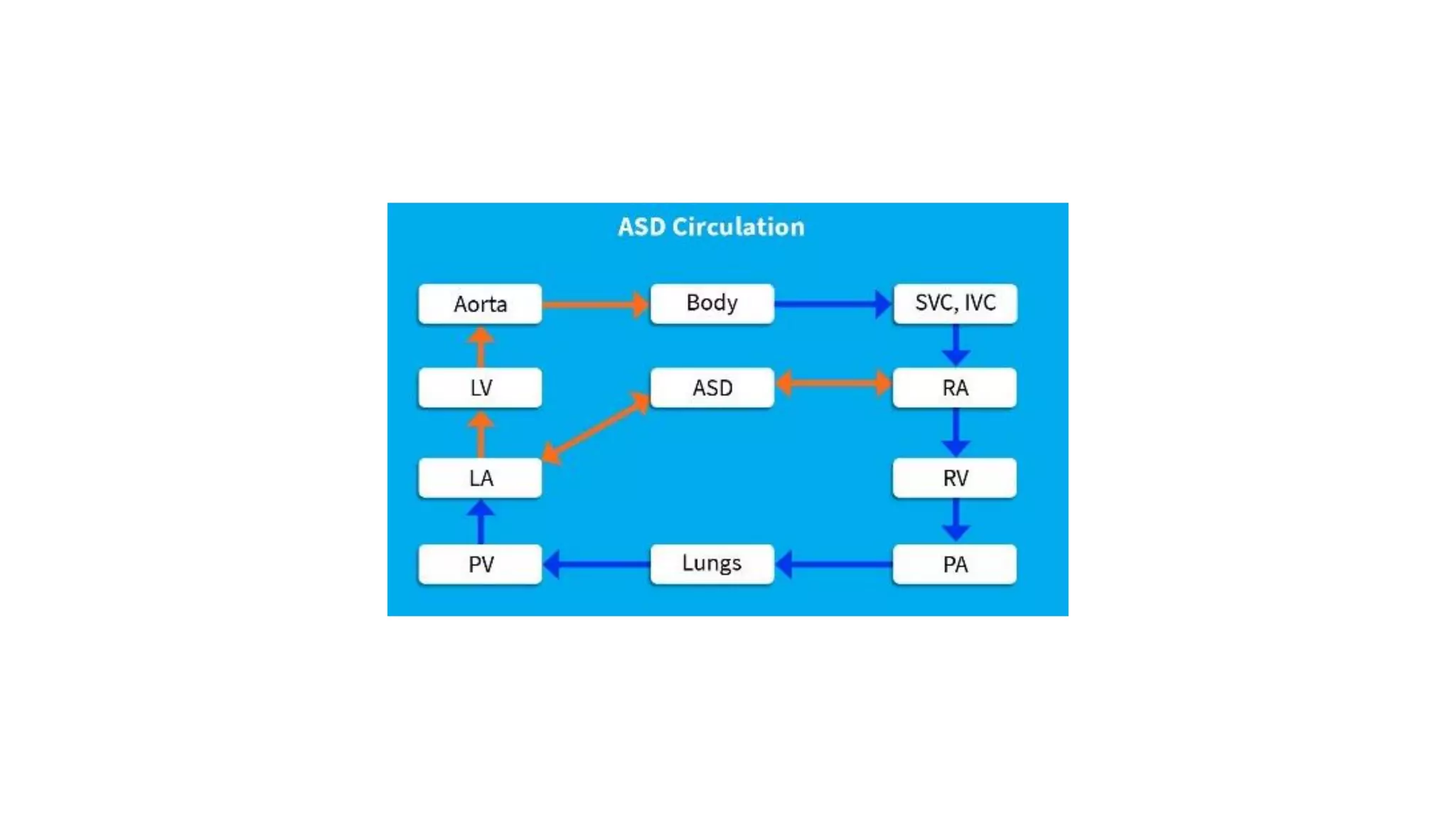 All You Need To Know About Atrial Septal Defect Ppt