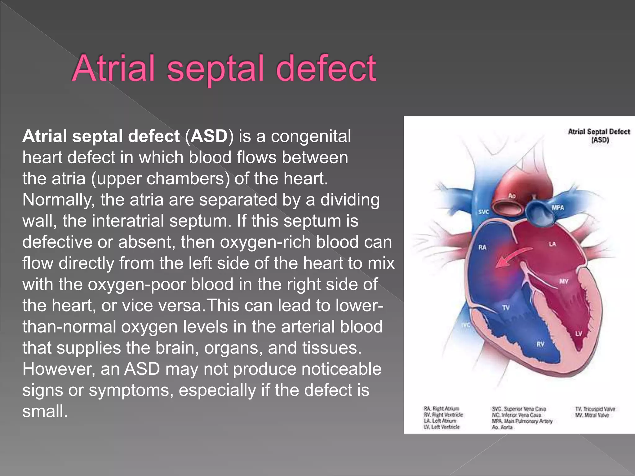 Atrial septal defect raj | PPTX | Heart and Cardiovascular Diseases ...