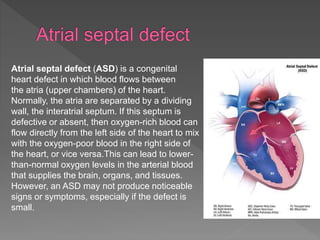 Atrial septal defect raj | PPTX | Heart and Cardiovascular Diseases ...
