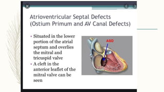 ATRIAL SEPTAL DEFECT Theory part for Pediatrics .pptx