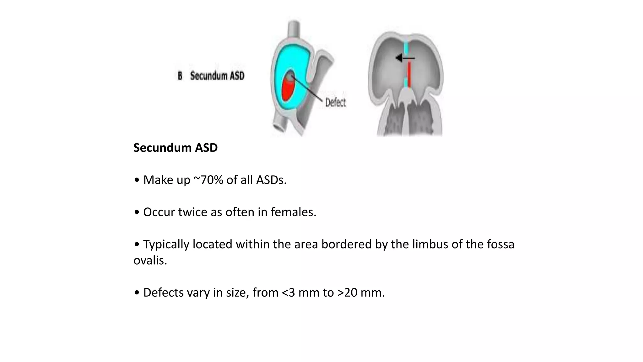 Atrial Septal Defects.pptx