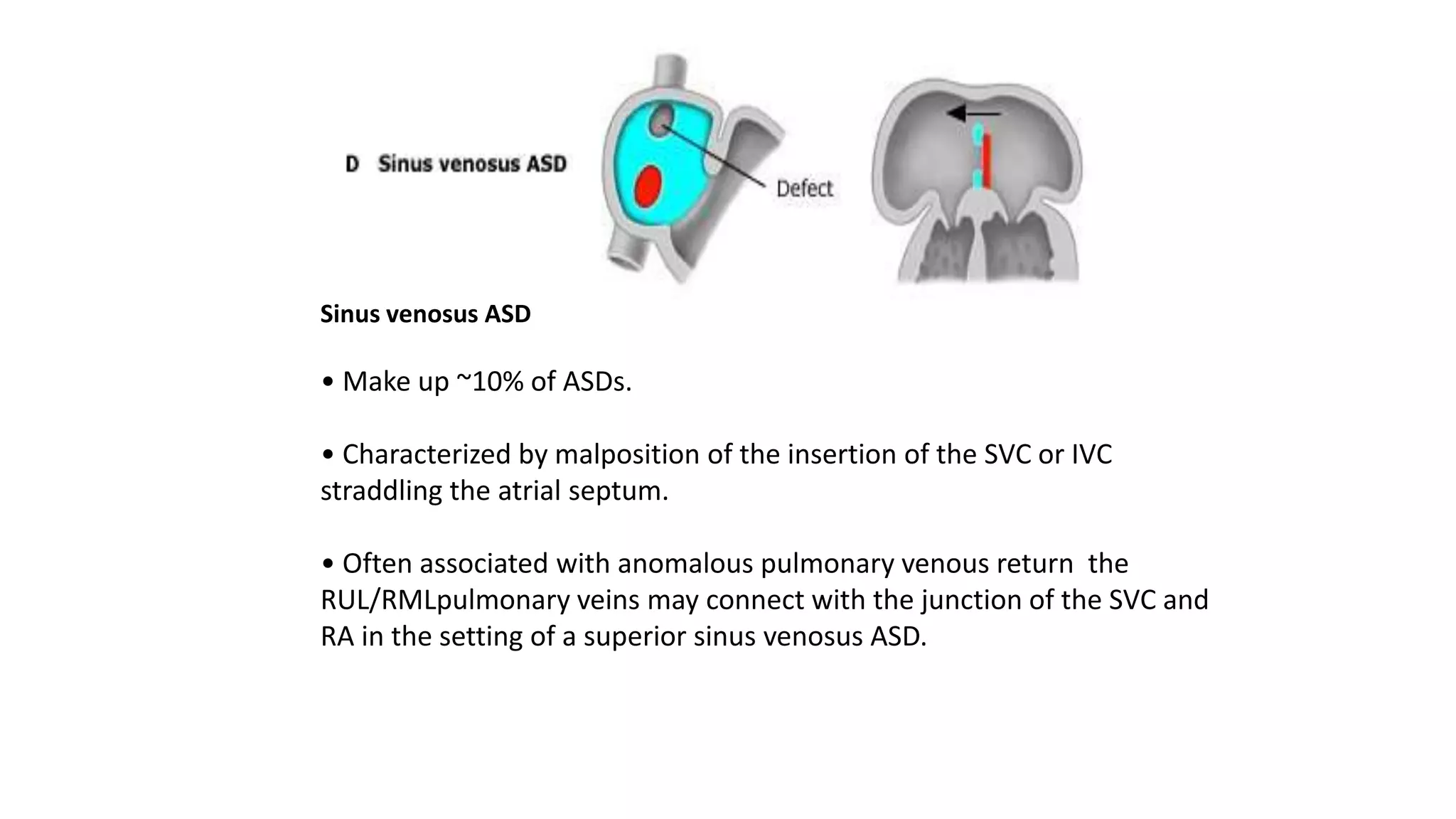Atrial Septal Defects.pptx