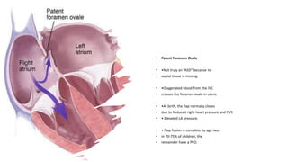 Atrial Septal Defects.pptx