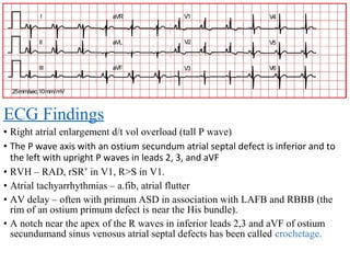 Atrial septal defects 16 3-15 | PPT