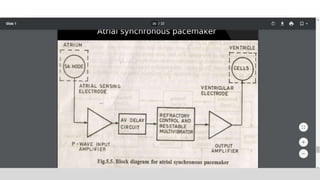Atrial synchronous pacemaker | Heart | PPTX