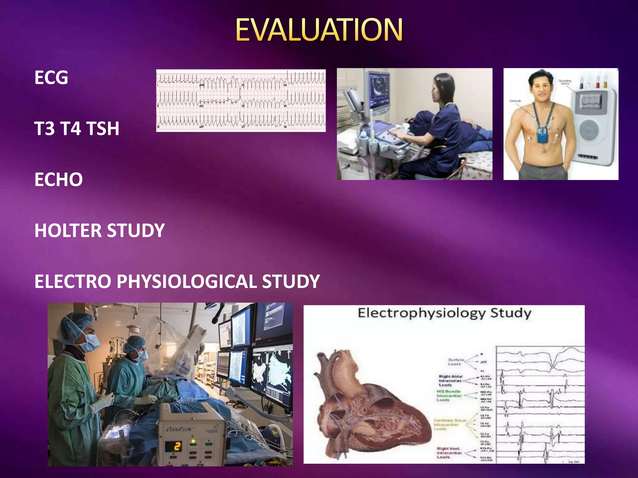 Atrial tachy 26 Oct 22.pptx