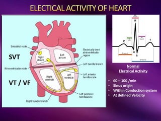 Atrial tachy 26 Oct 22.pptx