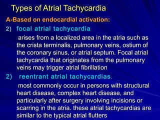 Atrial Tachycardia by Dr Aziz | PPT