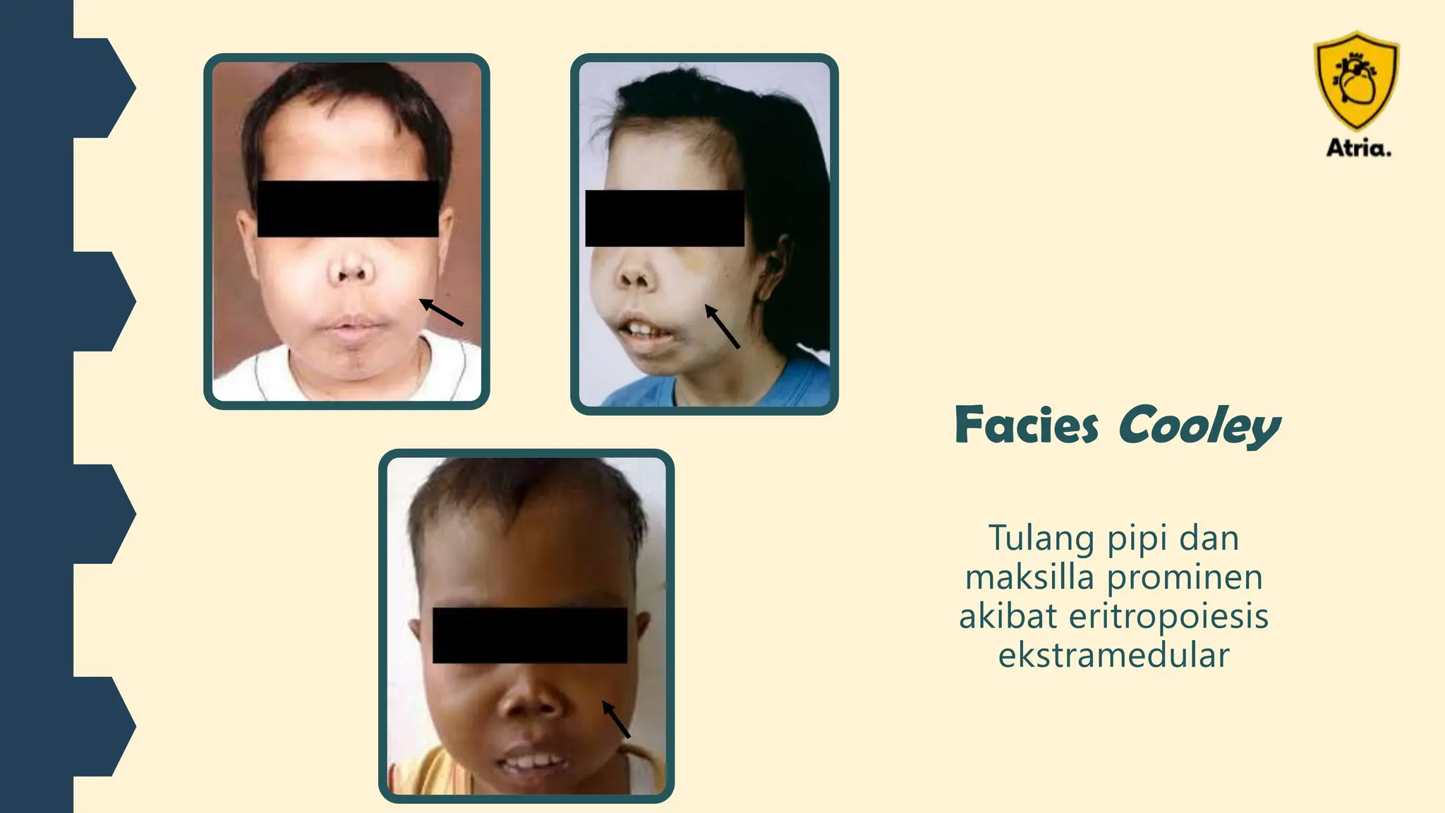 [ATRIA X UNISBA] Master Class Hemato-Onko.pdf