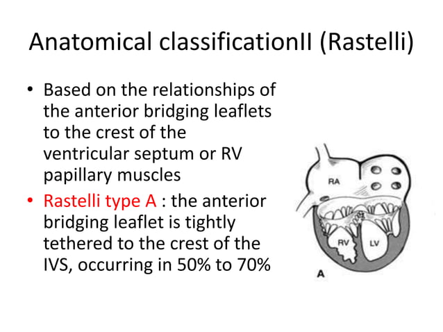 Atrioventricular canal defect | PPTX | Heart and Cardiovascular ...
