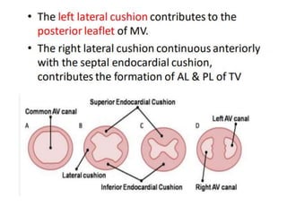 Atrioventricular canal defect | PPTX