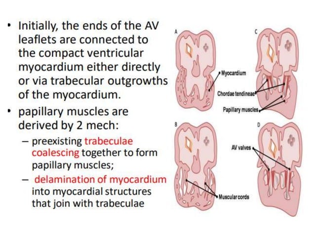 Atrioventricular canal defect | PPTX | Heart and Cardiovascular ...