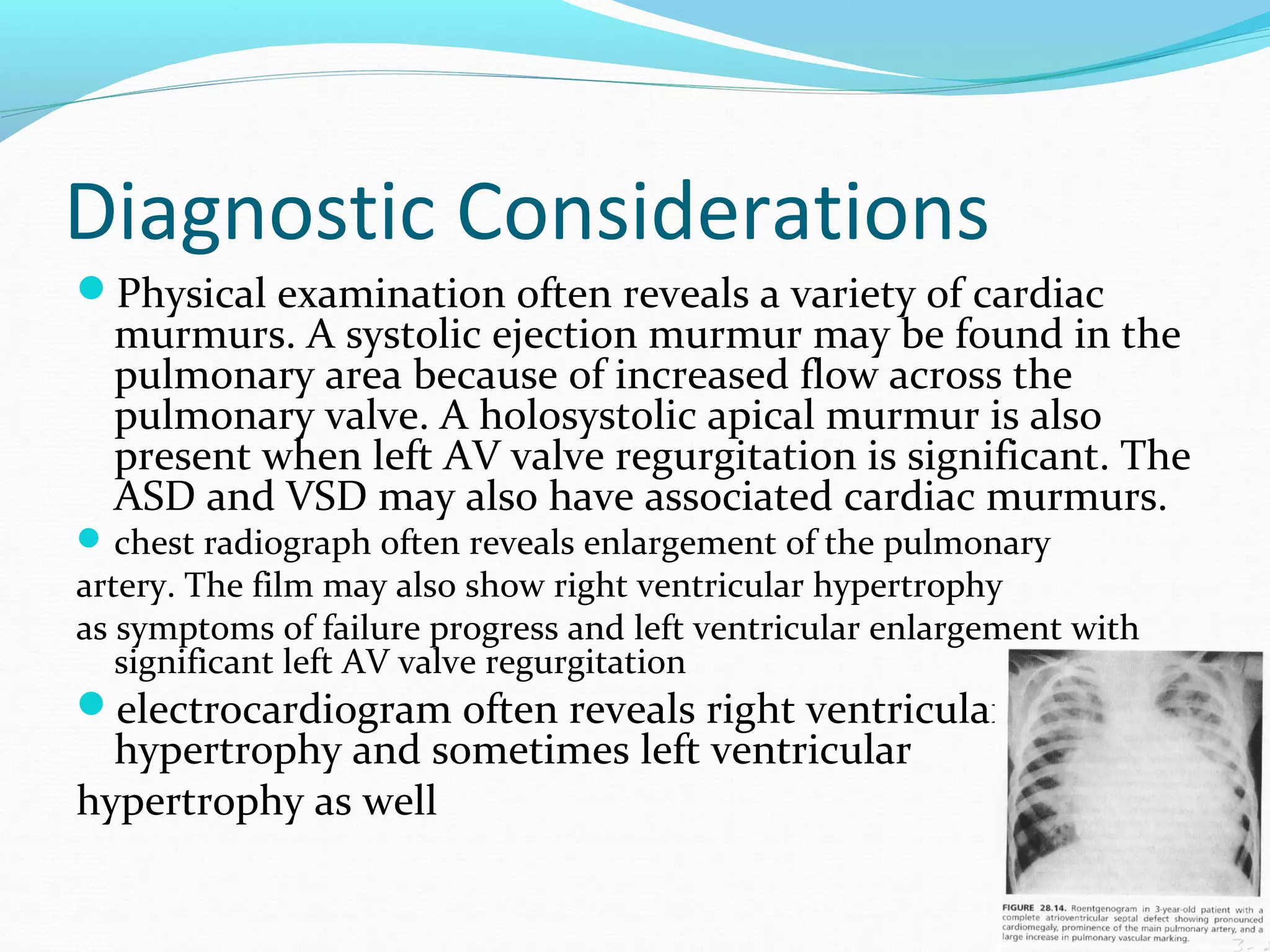 Atrioventricular canal defect, Firas Aljanadi,MD | PPT