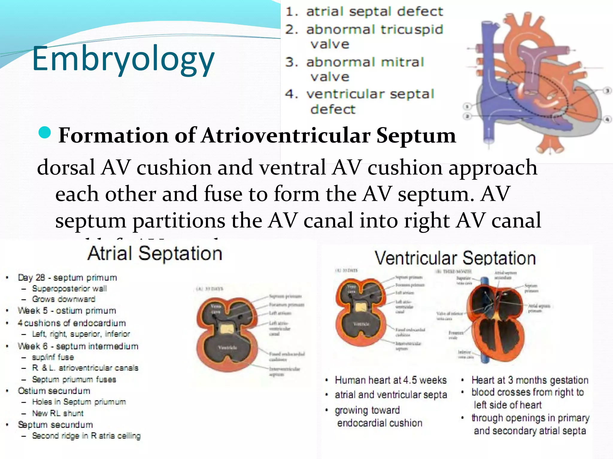 Atrioventricular canal defect, Firas Aljanadi,MD | PPT