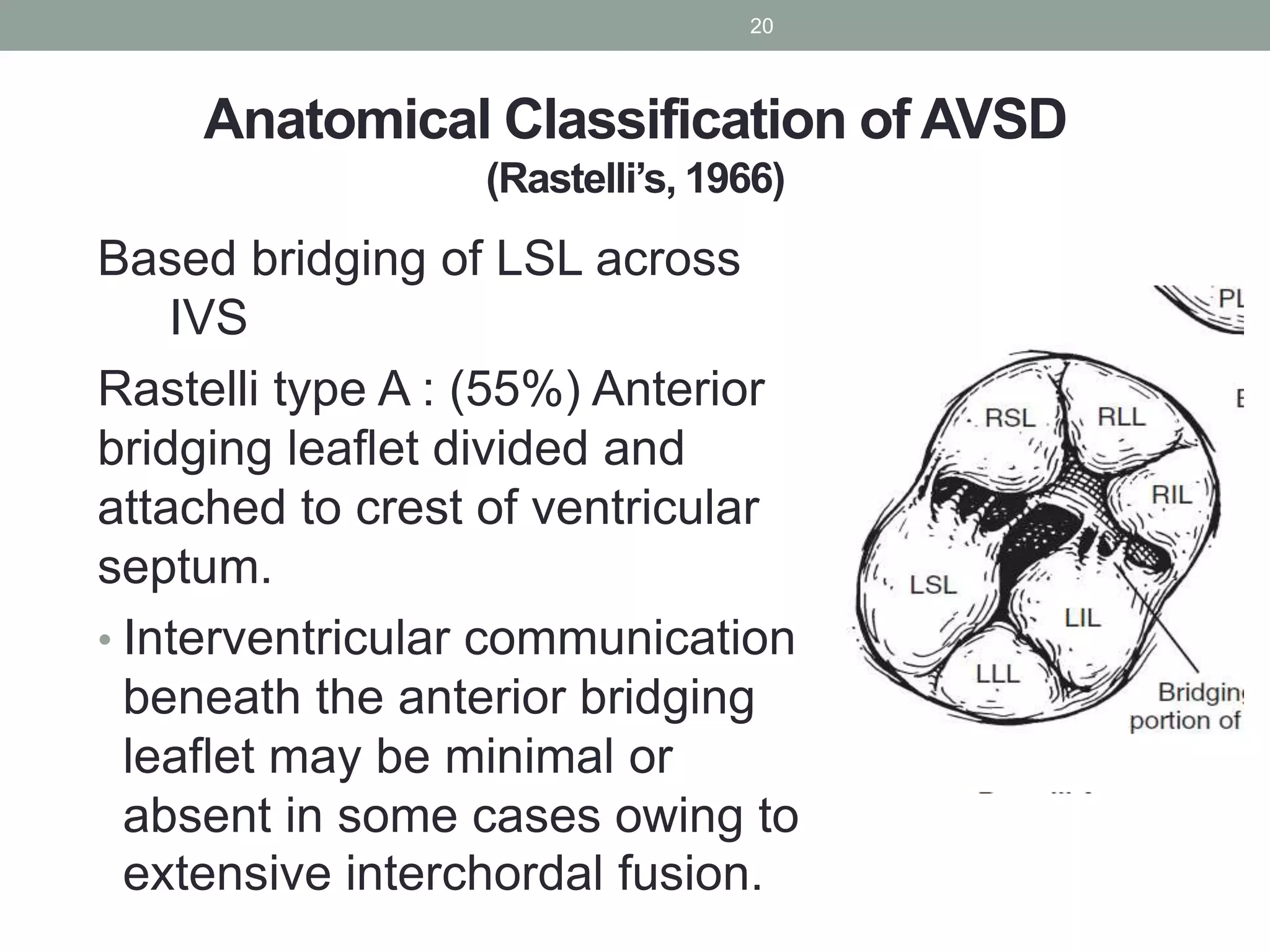 Atrioventricular septal defects | PPTX